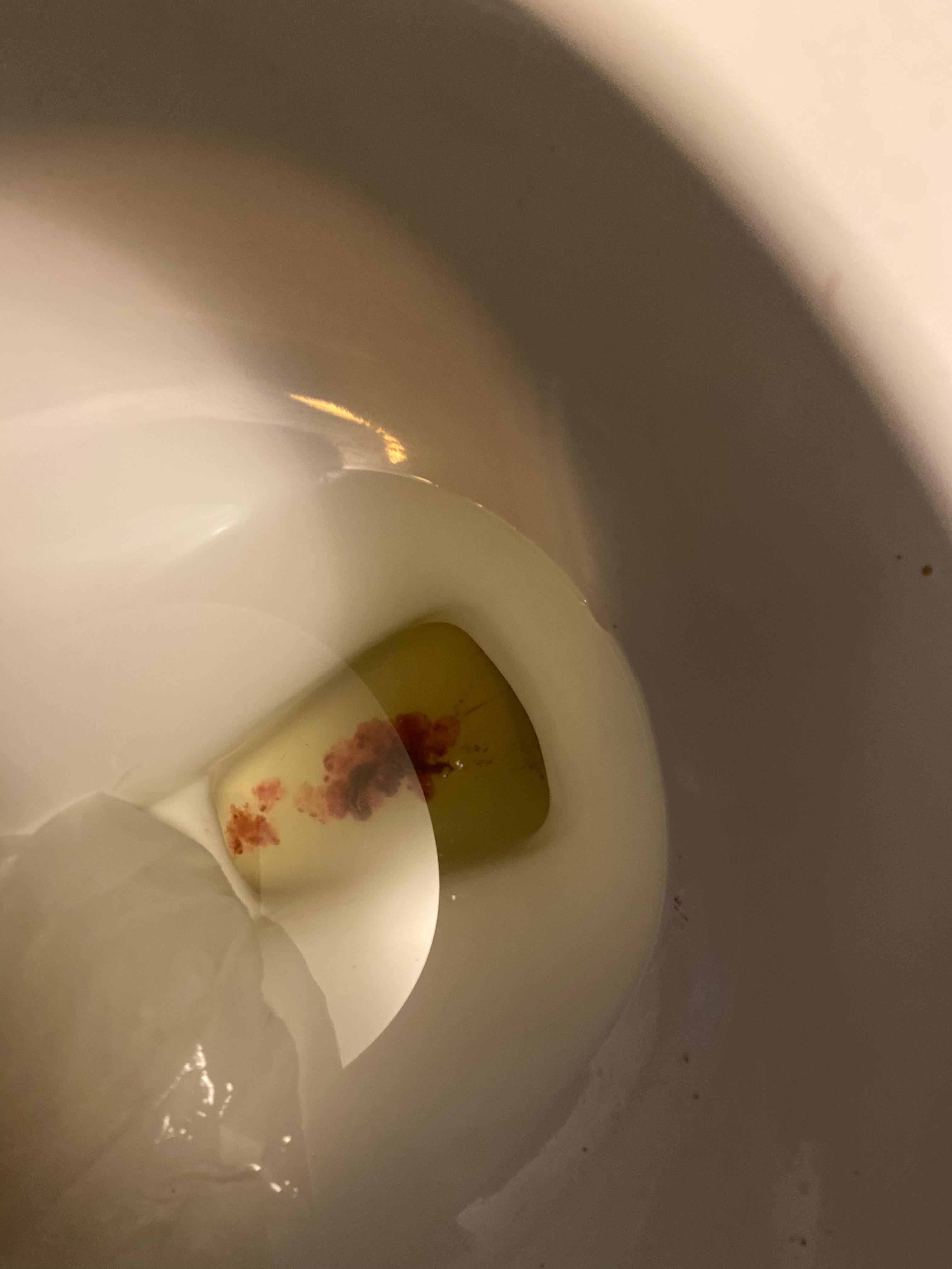 Bloody Mucus In Stool Constipation