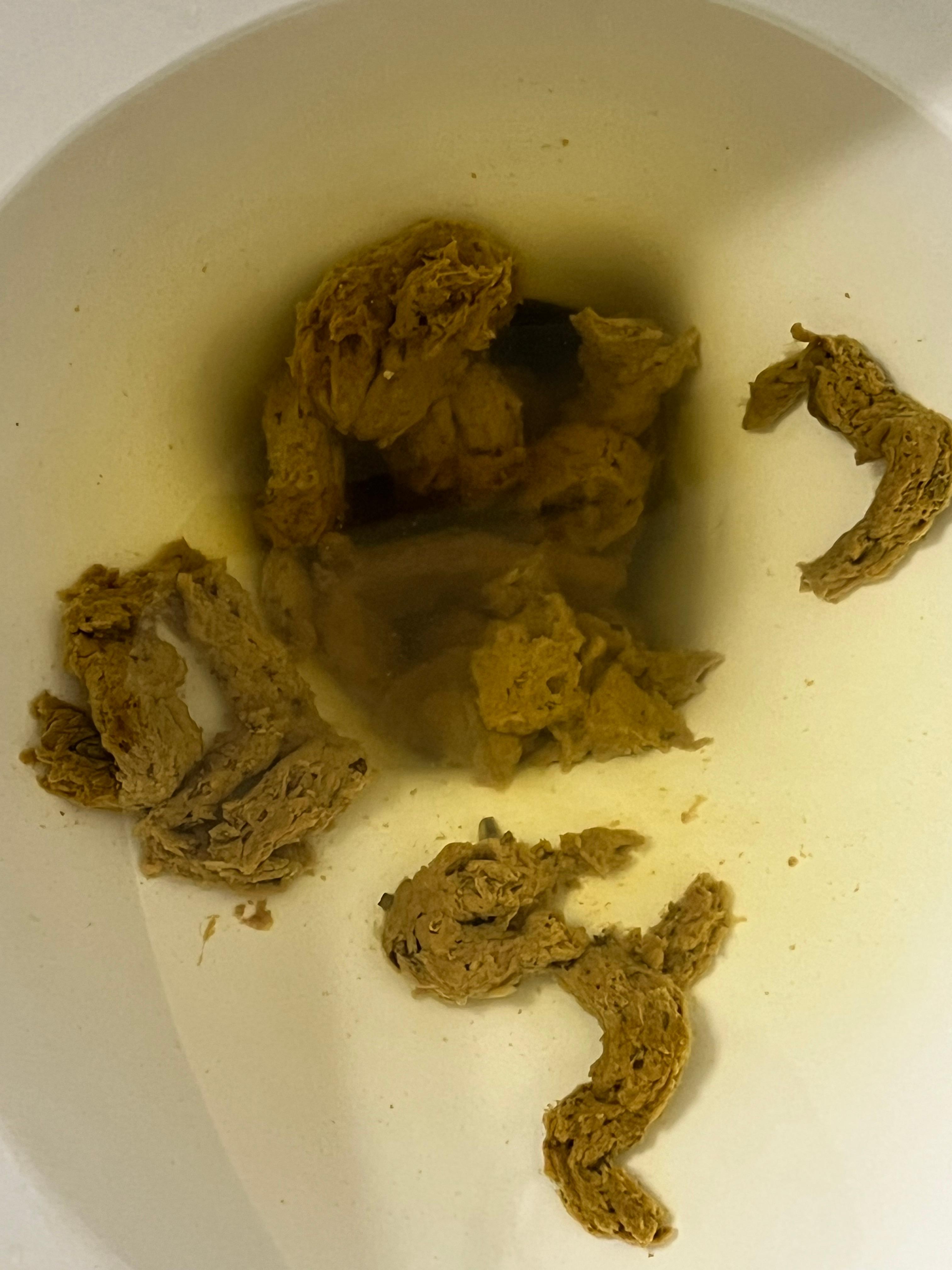 Colon Cancer Poop