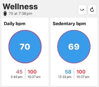 Wondering whether high and low bpm... | Atrial Fibrillati...
