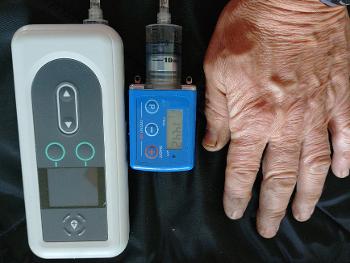 A discussion locally about the Vyalev / P... - Cure Parkinson's